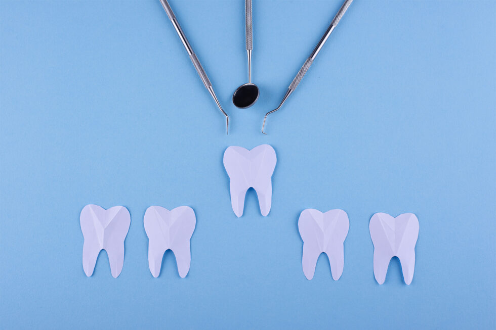 Dry Socket After Tooth Extraction - Langley Village Dental